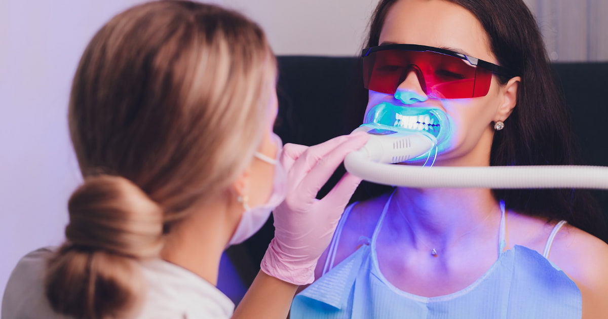Cost of Teeth Whitening North York - At-Home vs In-Office