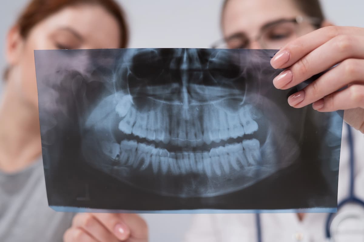 Exposed Tooth Root Pictures - What to Look For + Signs